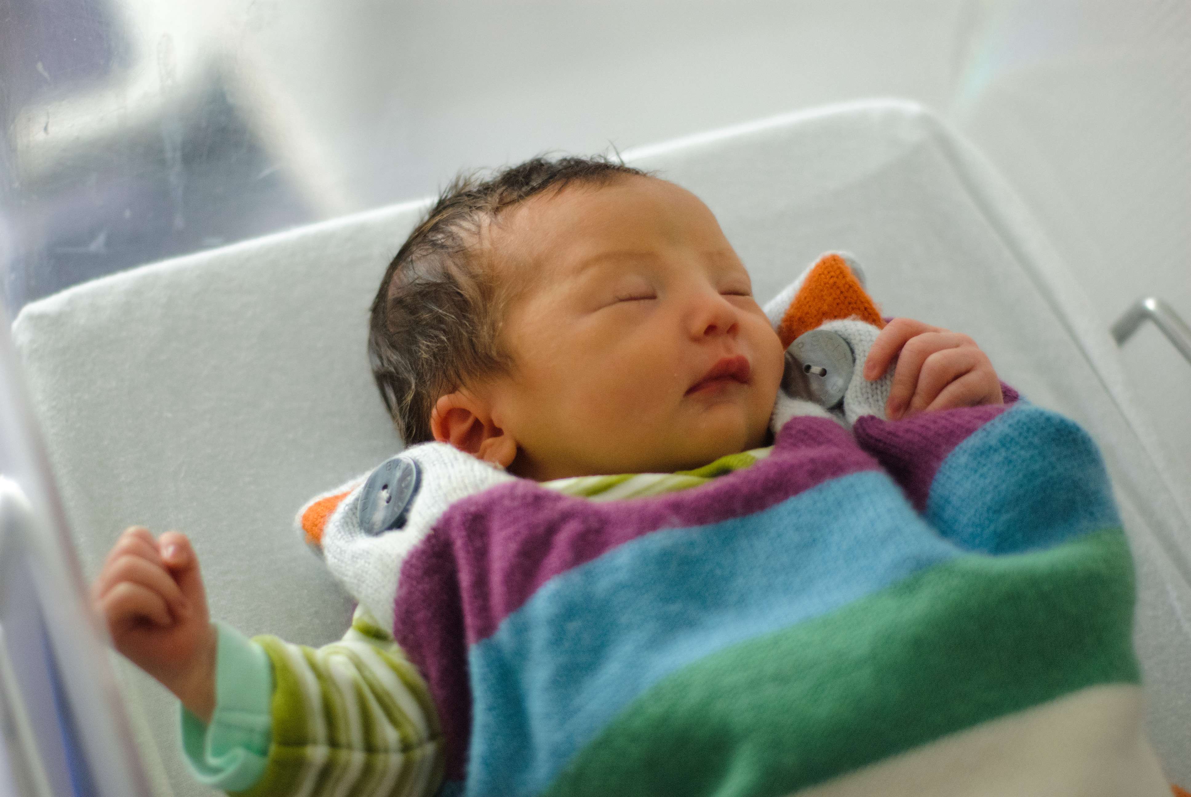 Síntoma y tratamiento de la ictericia en bebés