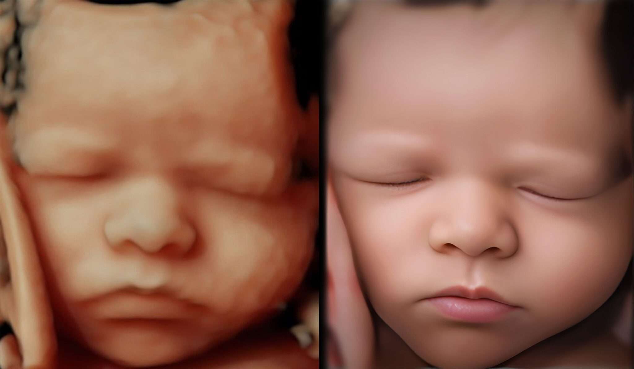 Nueva máquina de Be-ia que consigue ecografías hiperrealistas - Bebés y ...